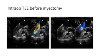 dilemma in hocm ].pptx