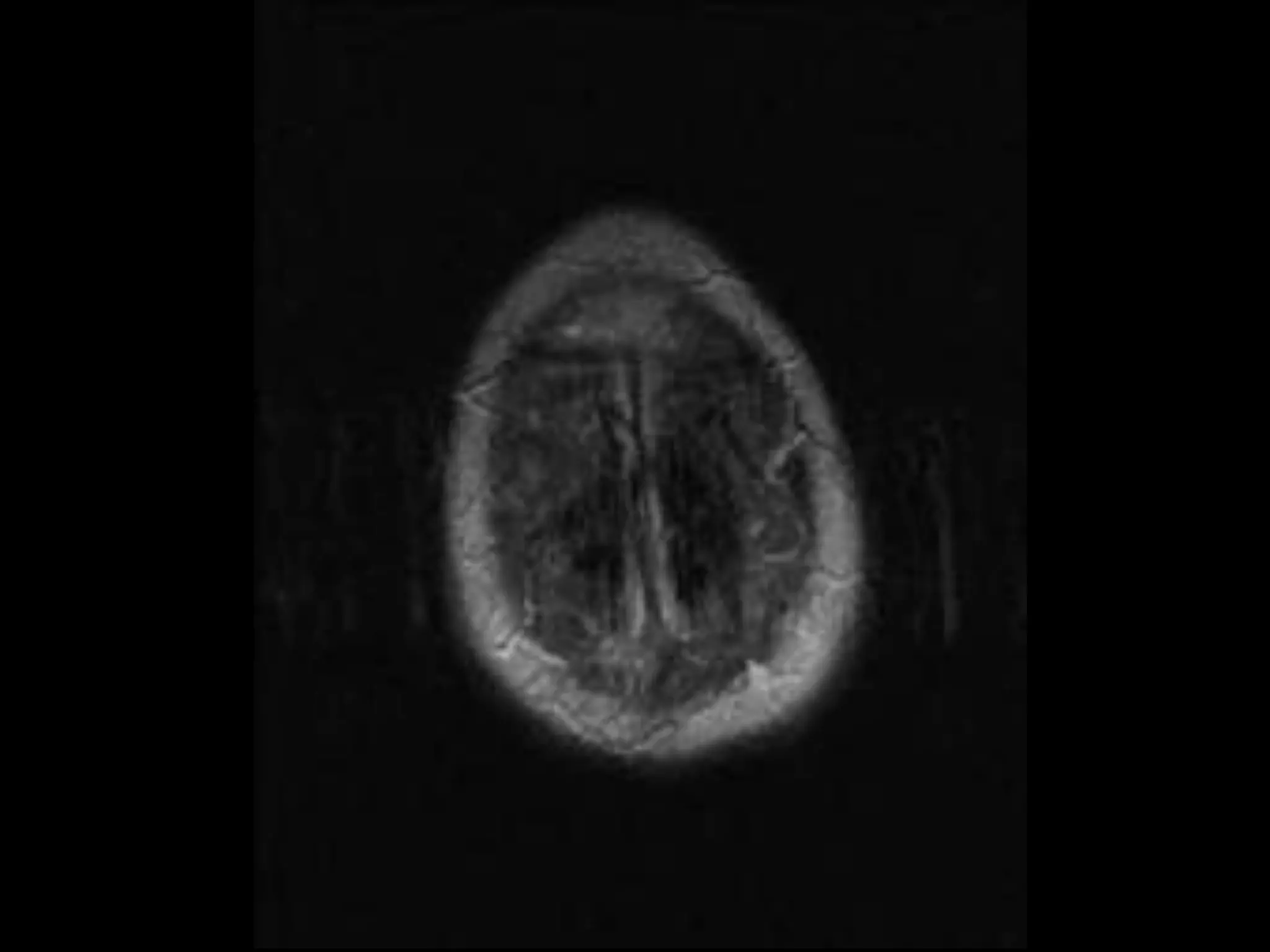 Sample brain slideshow | PPTX