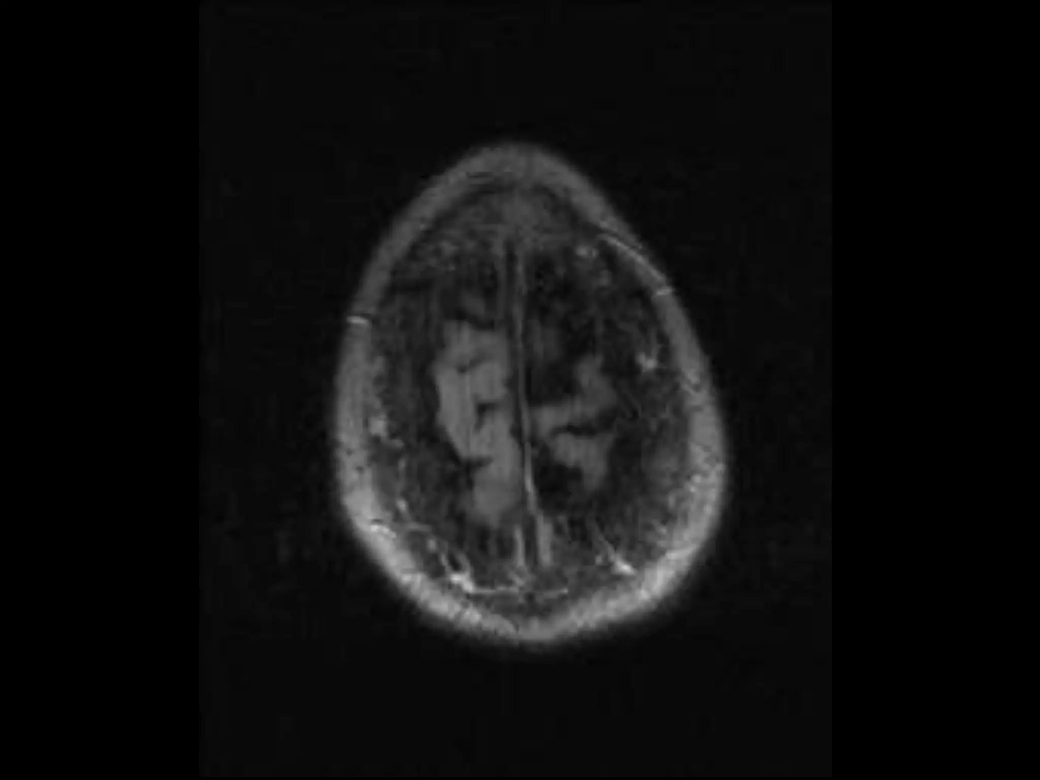 Sample brain slideshow | PPTX