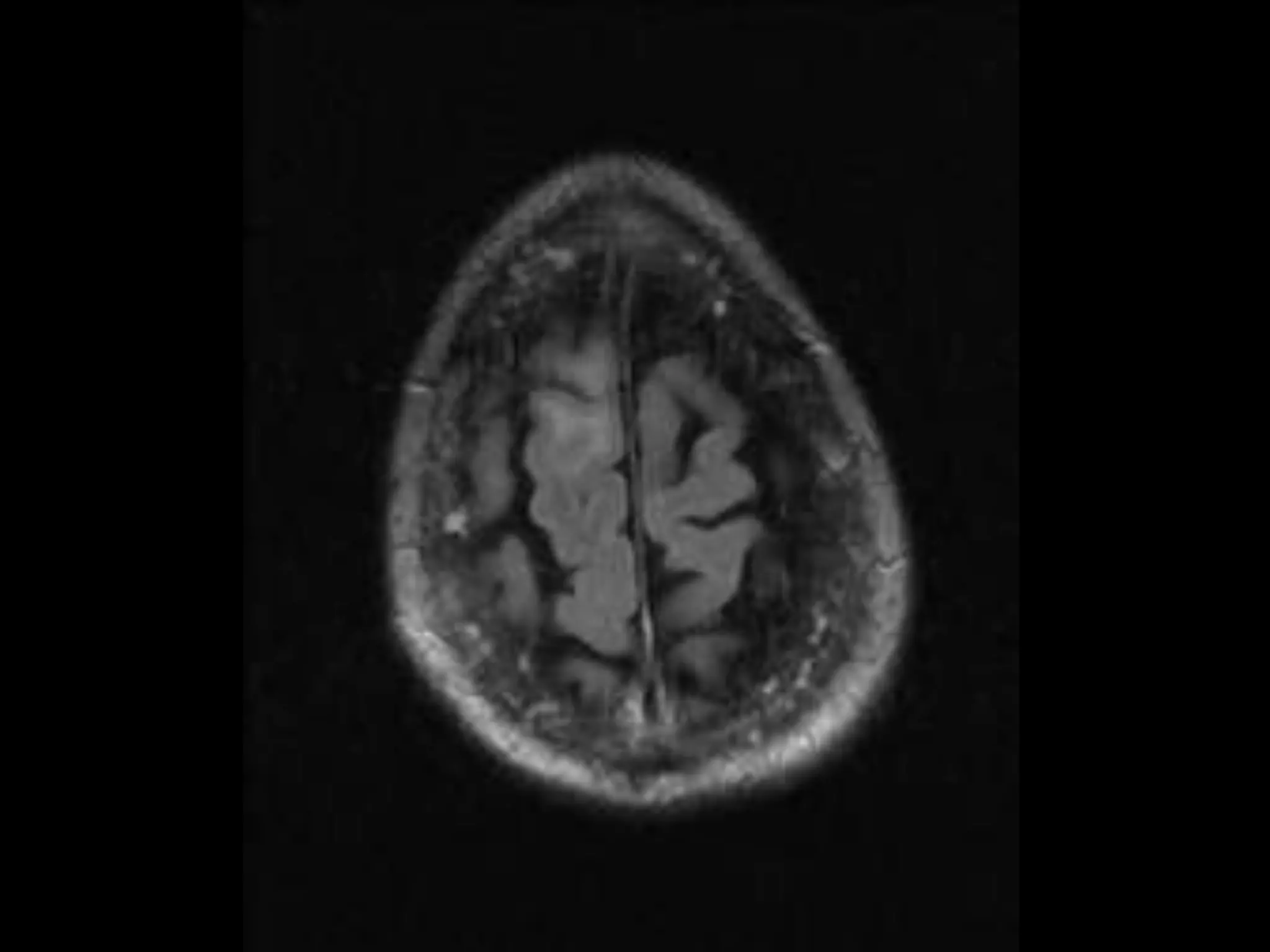 Sample brain slideshow | PPTX