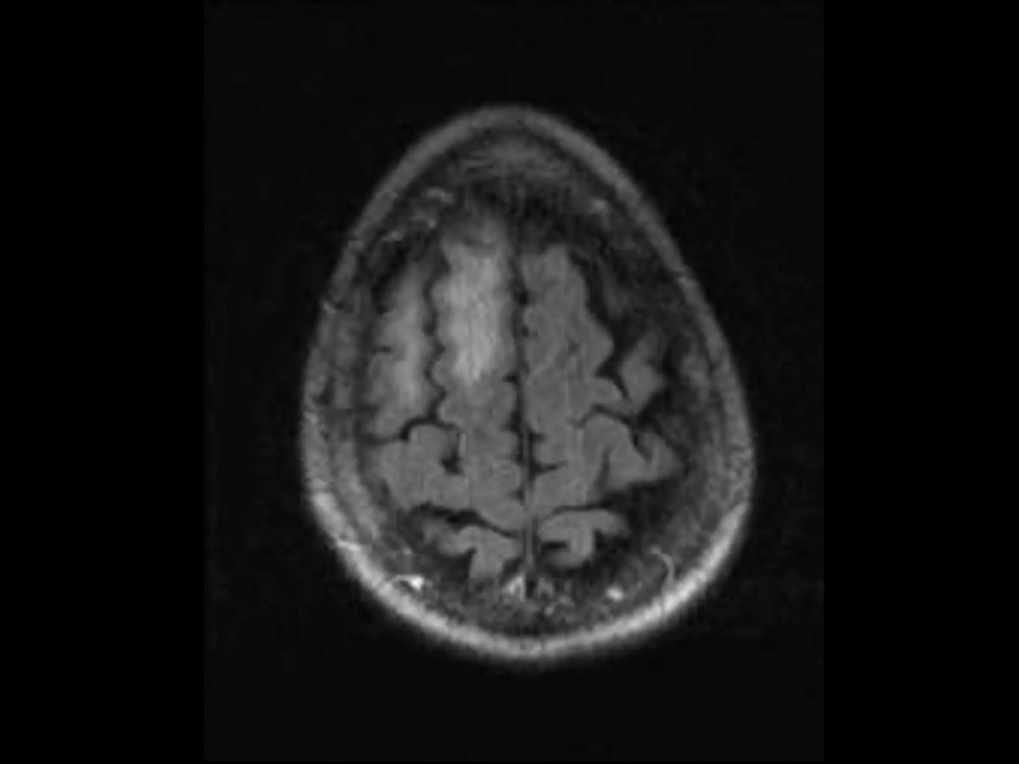 Sample brain slideshow | PPTX