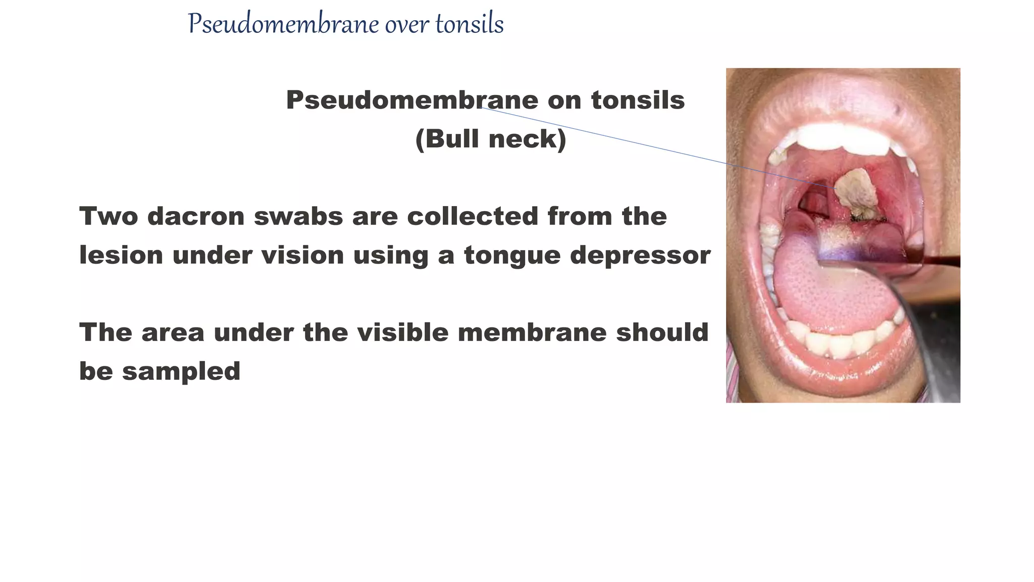 Sample collection in clinical microbiology.pptx