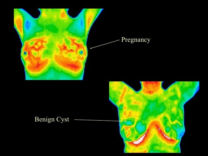 THERMOGRAM EXAMPLE IMAGES WITH EXPLANATIONS