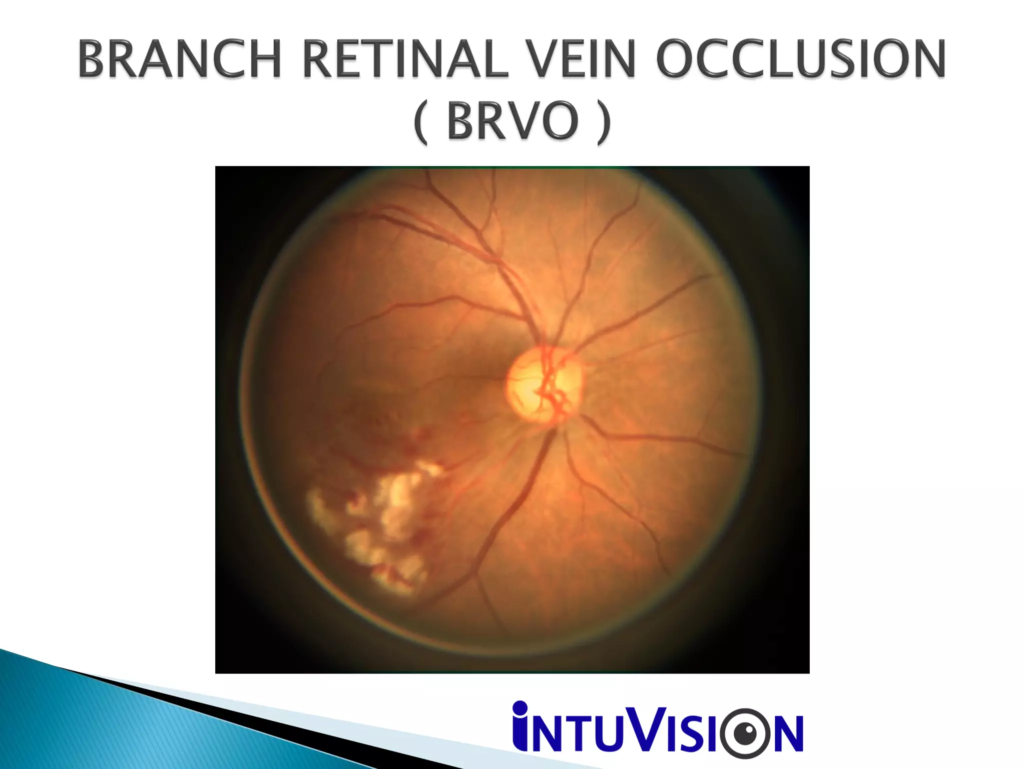 Sample Retinal Images | PDF