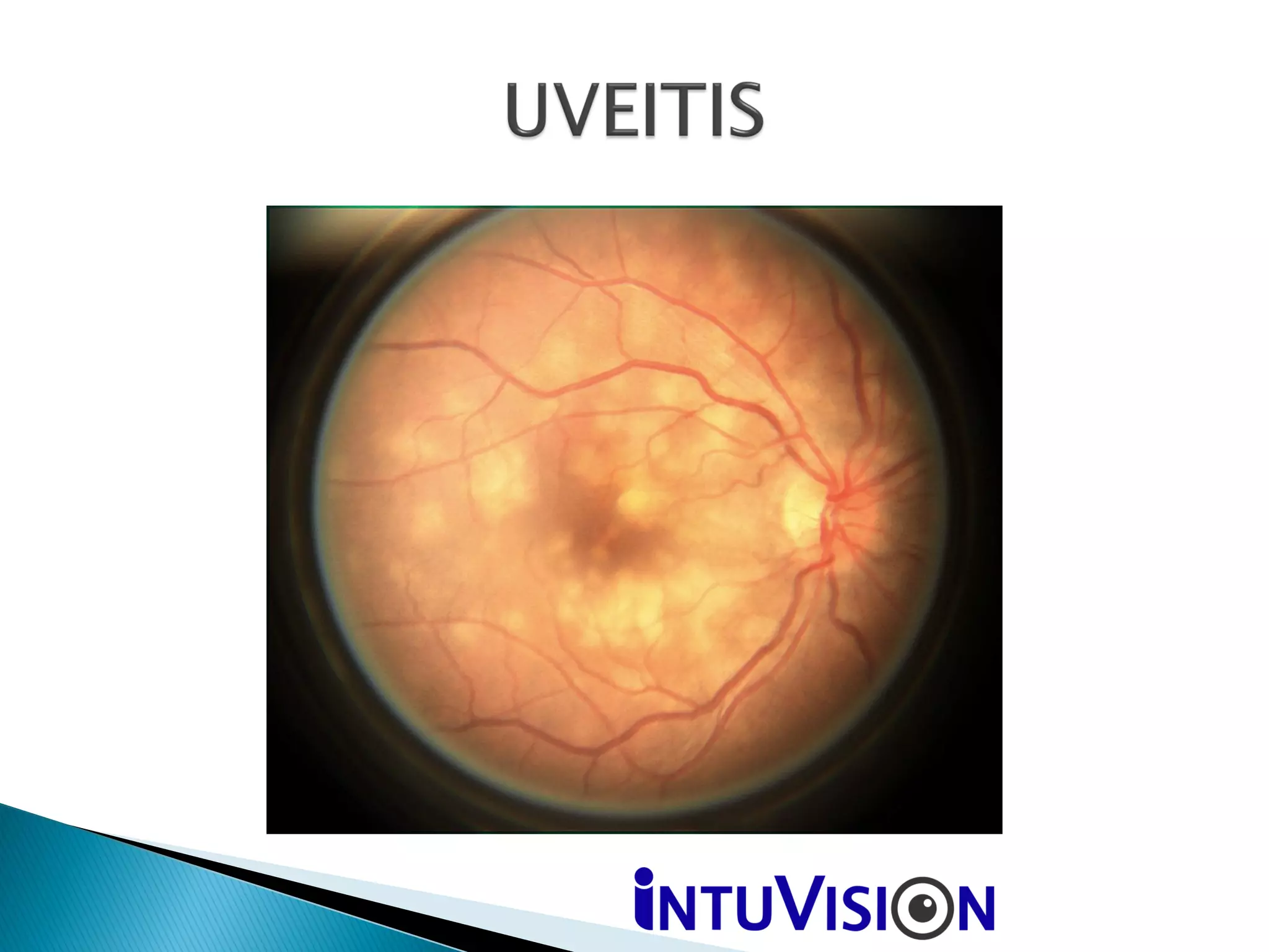 Sample Retinal Images | PDF
