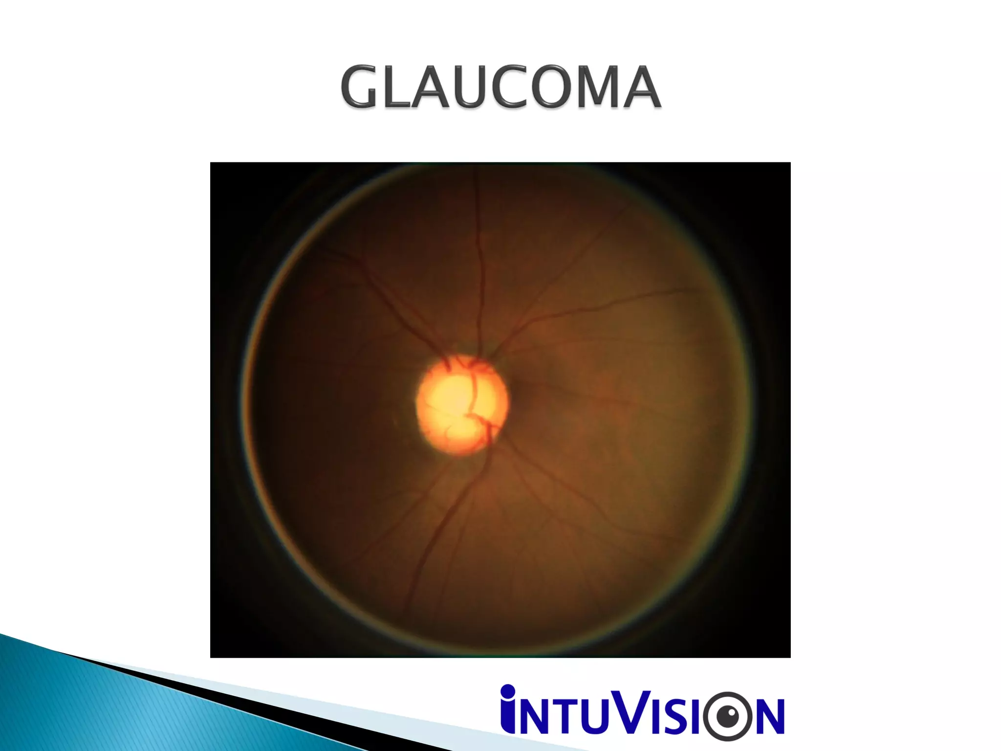 Sample Retinal Images | PDF
