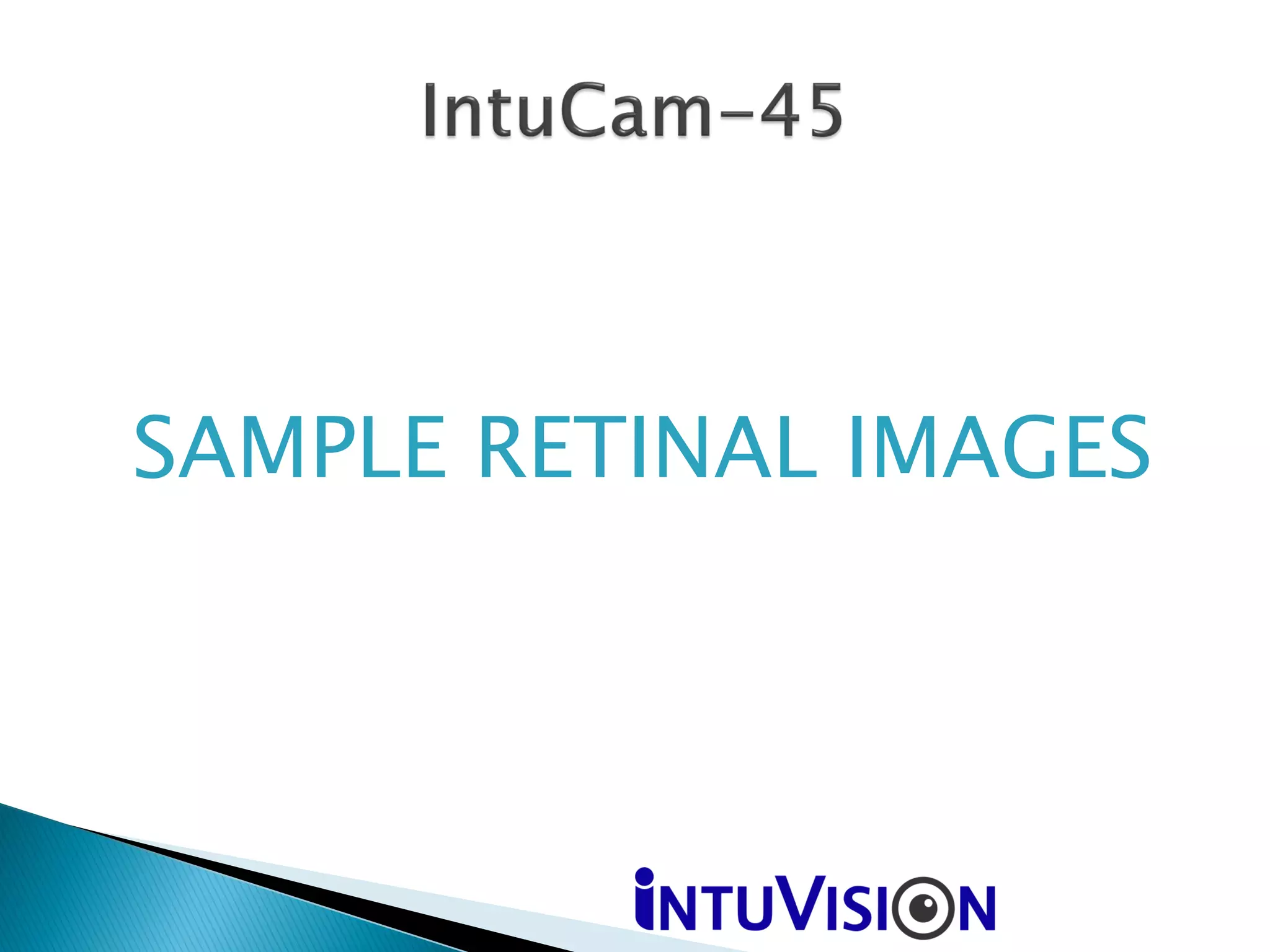 Sample Retinal Images | PDF