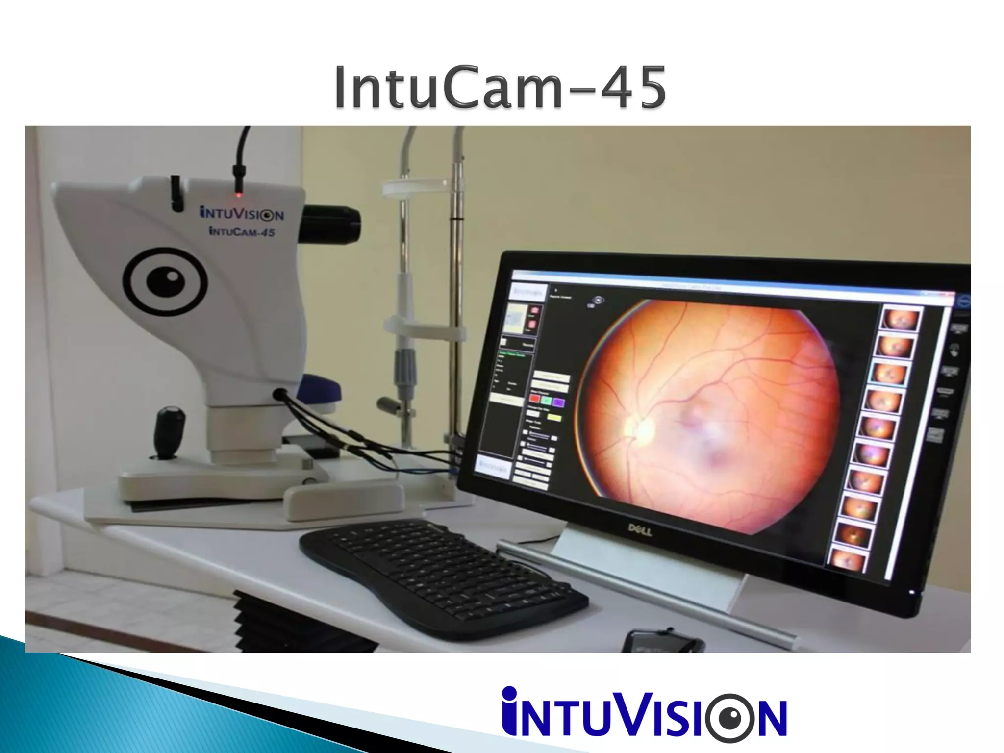 Sample Retinal Images | PDF
