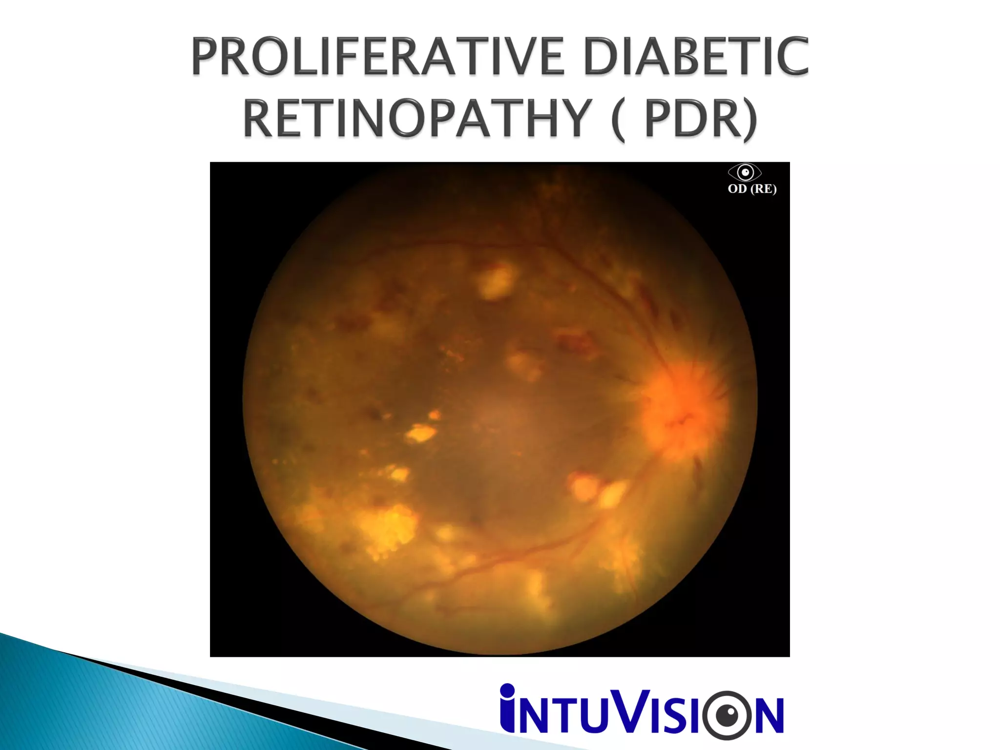 Sample Retinal Images | PDF