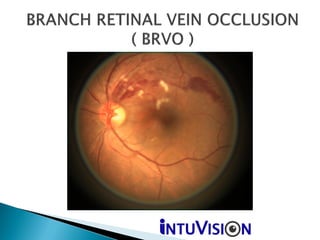Sample Retinal Images | PDF