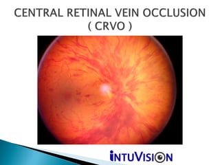 Sample Retinal Images | PDF
