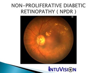 Sample Retinal Images | PDF