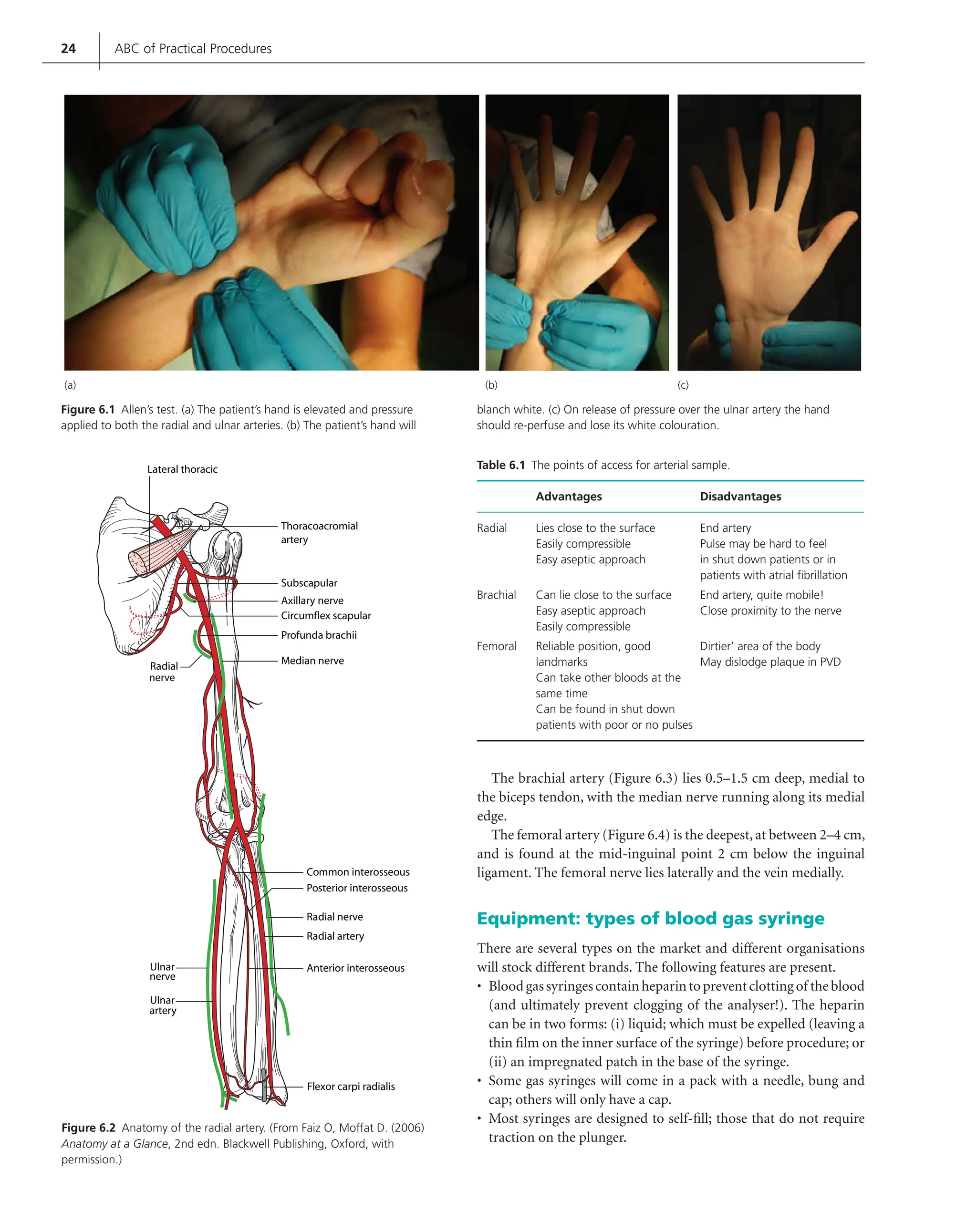 Sampling Arterial Blood Gases Procedures | PDF