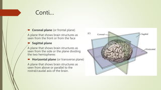 Parts of Brain mainly the Forebrain .pptx