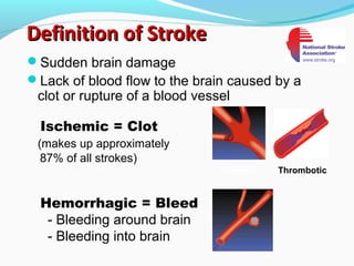 Sam stroke community_presentation_guide | PPT
