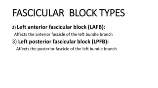 Fascicular block ECG Student explanation presentation topic(1).pdf
