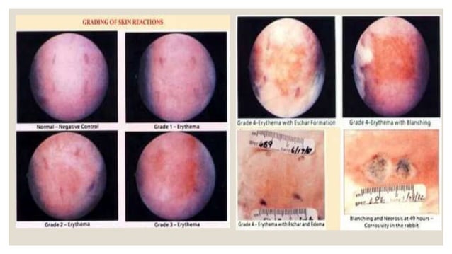 DERMAL IRRITATION STUDY ACCORDING TO OECD(404) GUIDELINES | PPTX