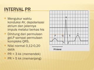 Mengenal tatalaksana tentang SA n AV block - dayat.ppt