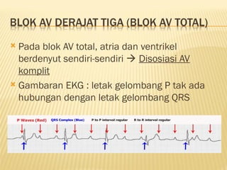 Mengenal tatalaksana tentang SA n AV block - dayat.ppt