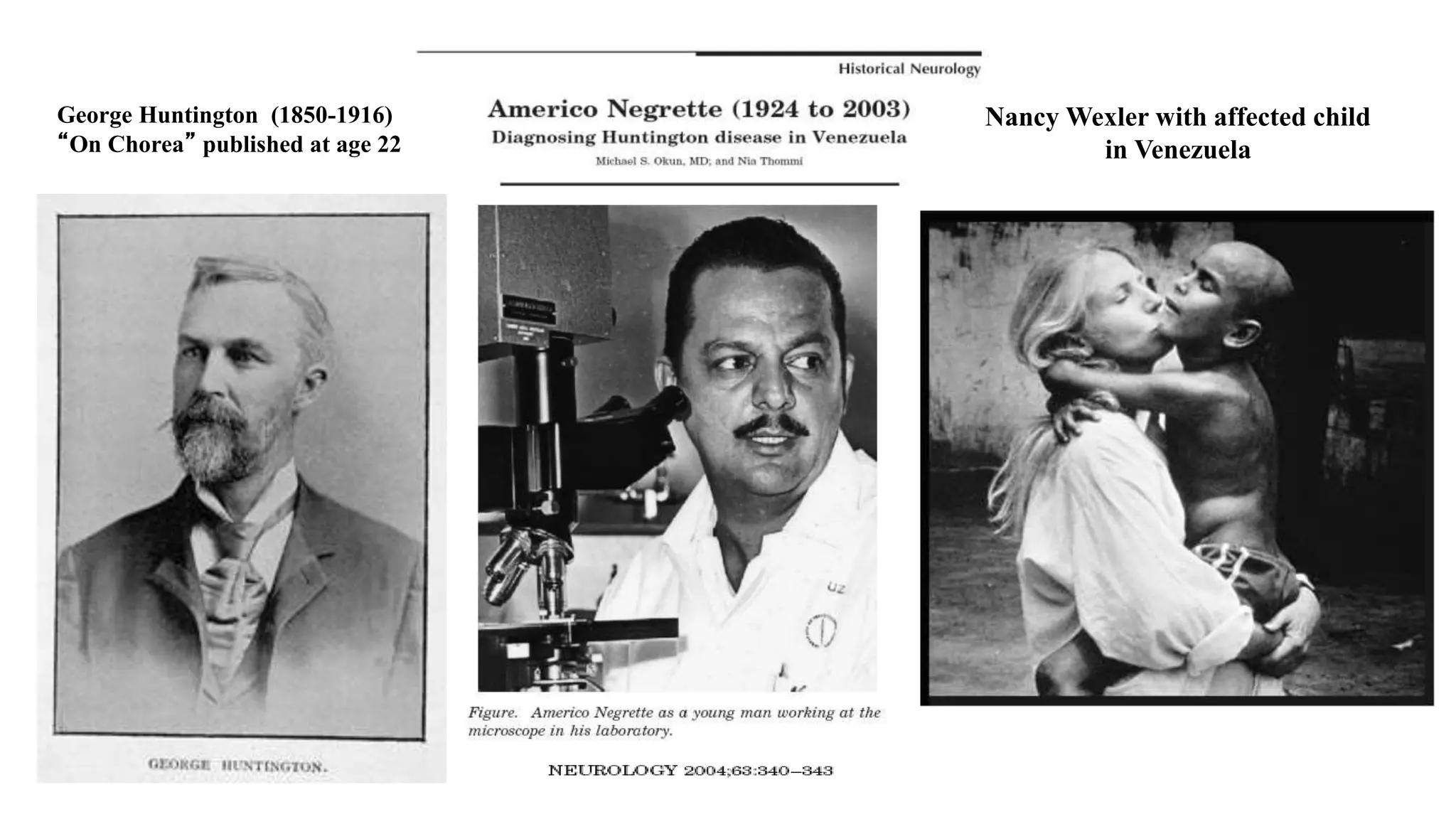 The Natural History and Clinical Progression of Huntington’s Disease in ...