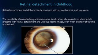 Differential diagnosis of congenital cataract | PPT