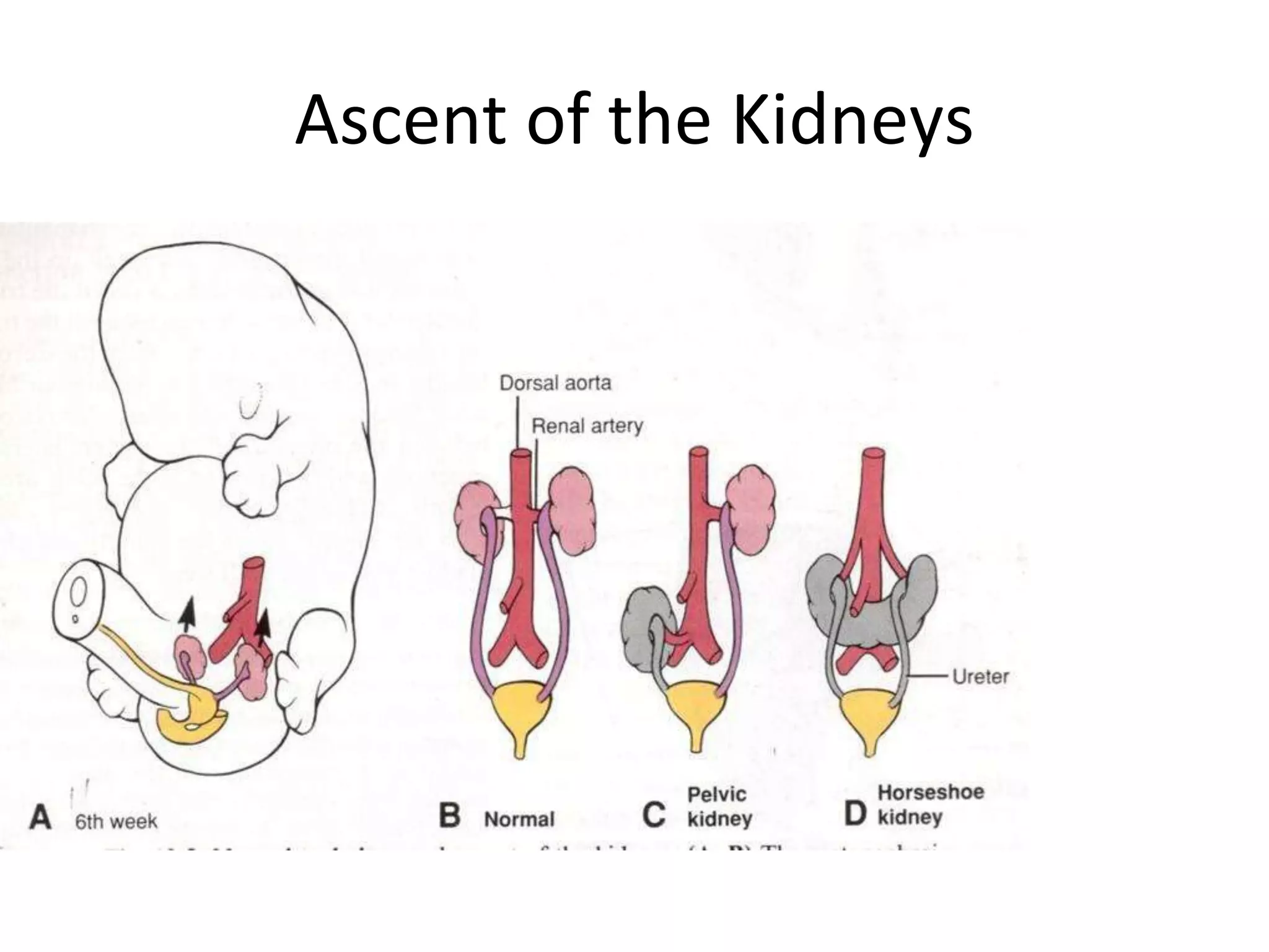 sandeep KIDNEY DEVELOPMENT PPT.ppt