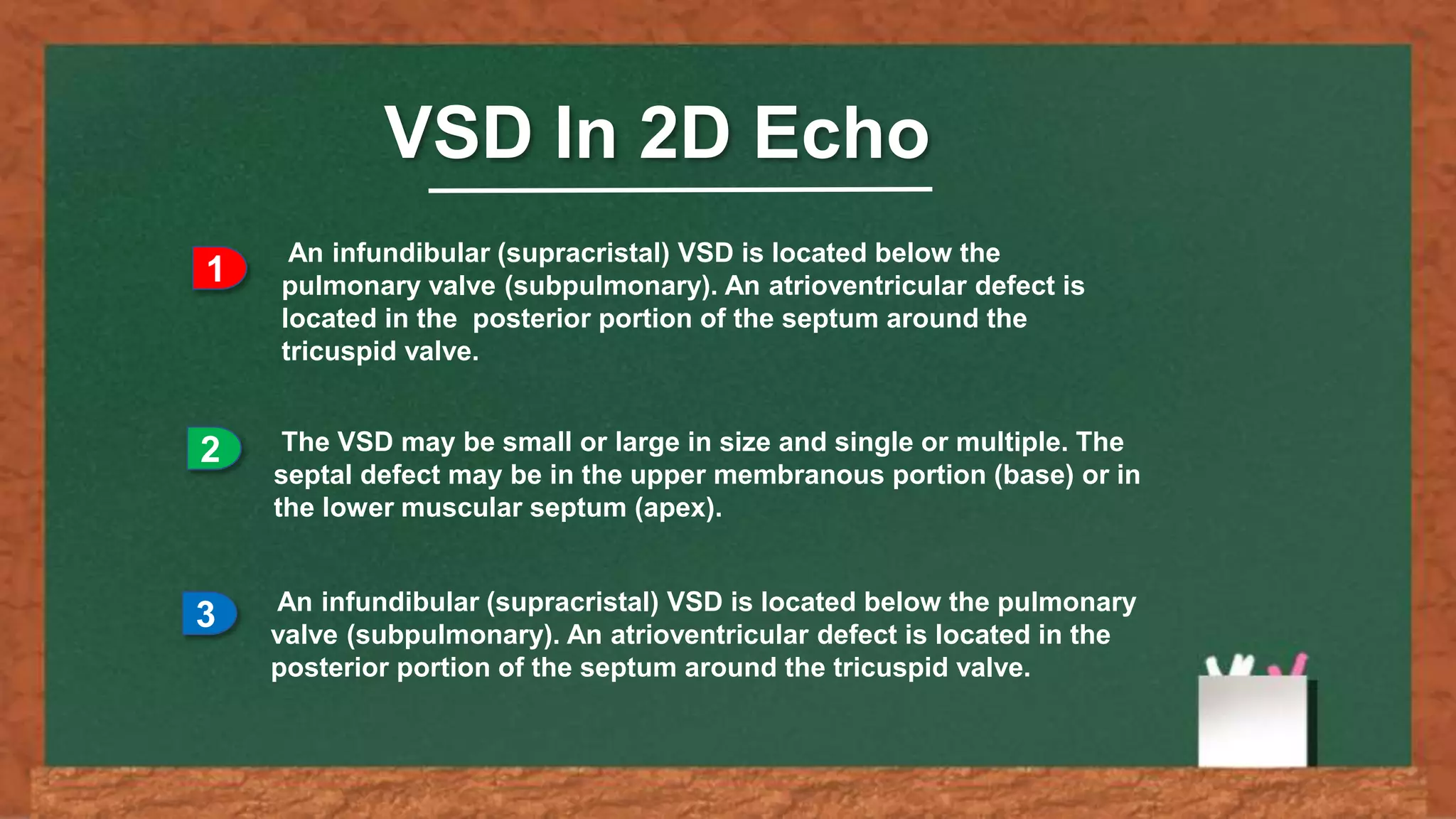 VSD by Sandeep Sengar | PPTX