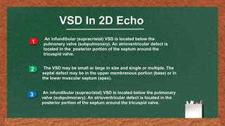 VSD by Sandeep Sengar | PPTX