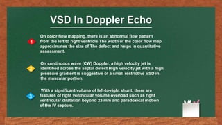 VSD by Sandeep Sengar | PPTX