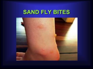 sand fly | PPT
