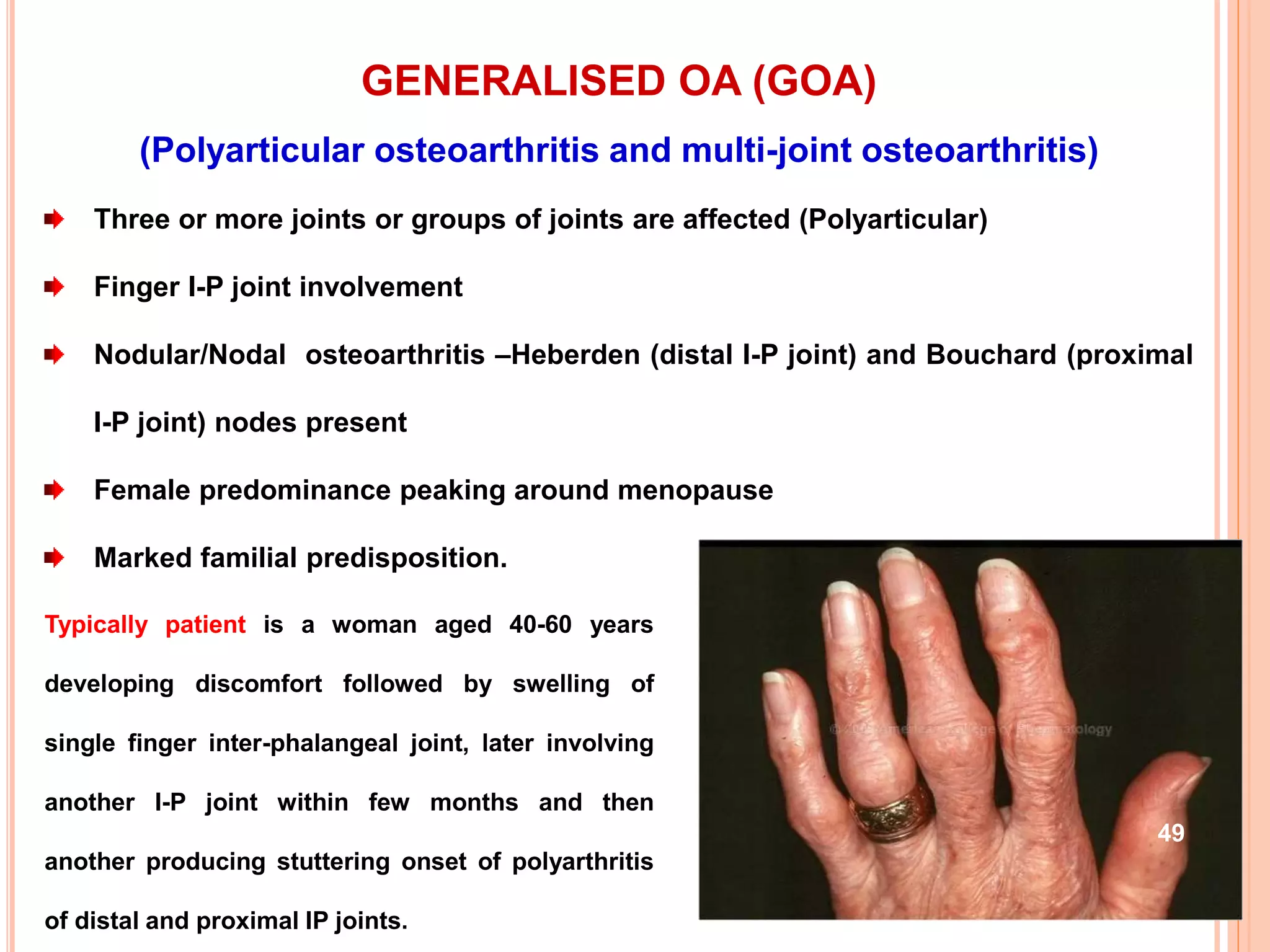 Sandhivata (osteoarthritis) | PPSX