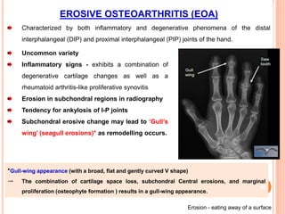 Sandhivata (osteoarthritis) | PPSX
