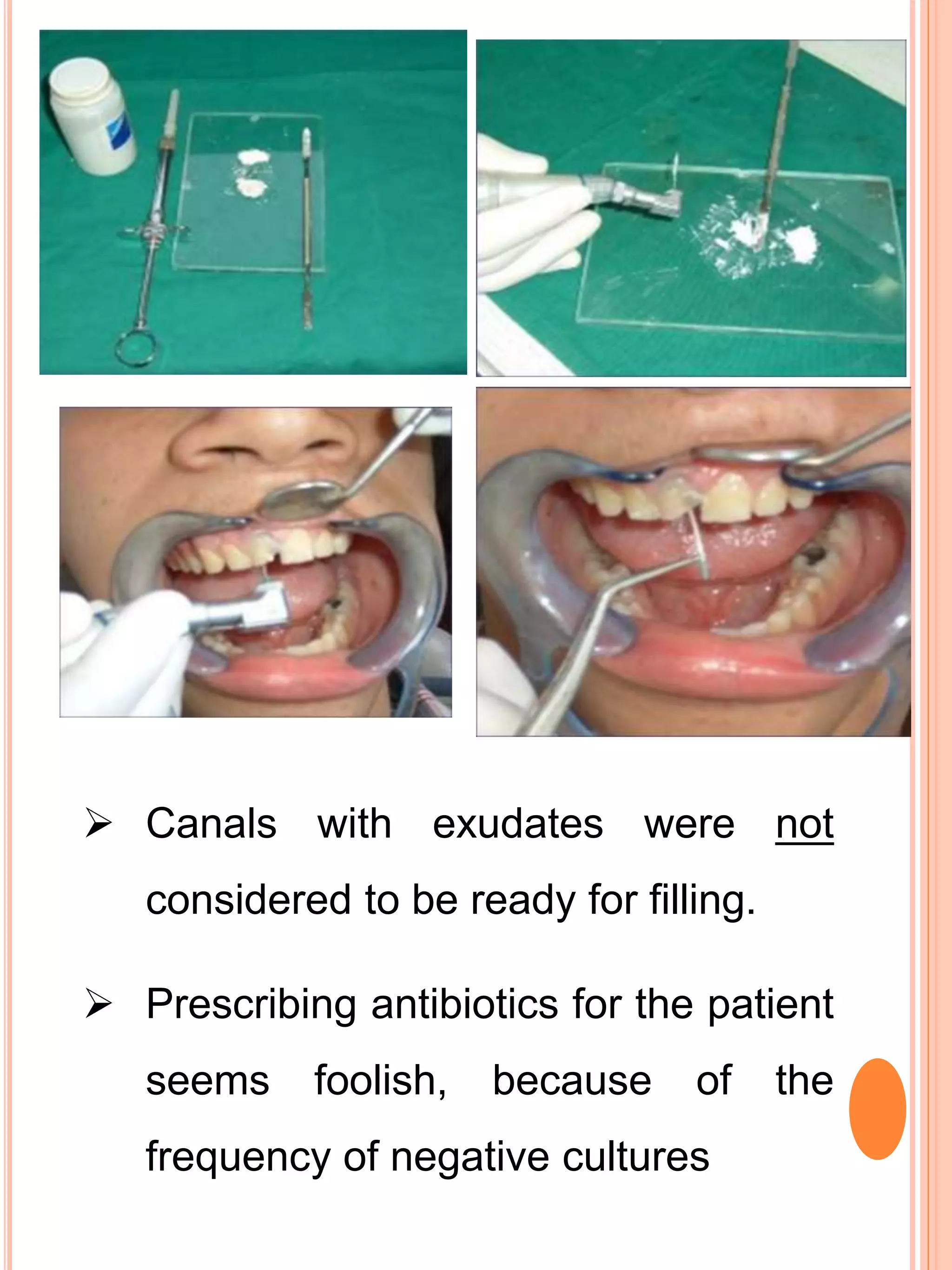 INTRACANAL MEDICAMENTS IN ENDODONTICS | PPTX
