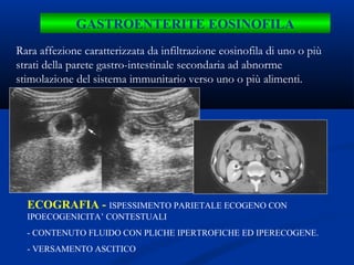 Malassorbimento intestinale nel bambino: ruolo dell'ecografia | PPT