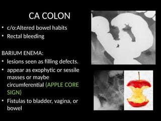 RADIOLOGY OF GIT ,RADIOLOGICAL APPROACH TO GIT .pptx