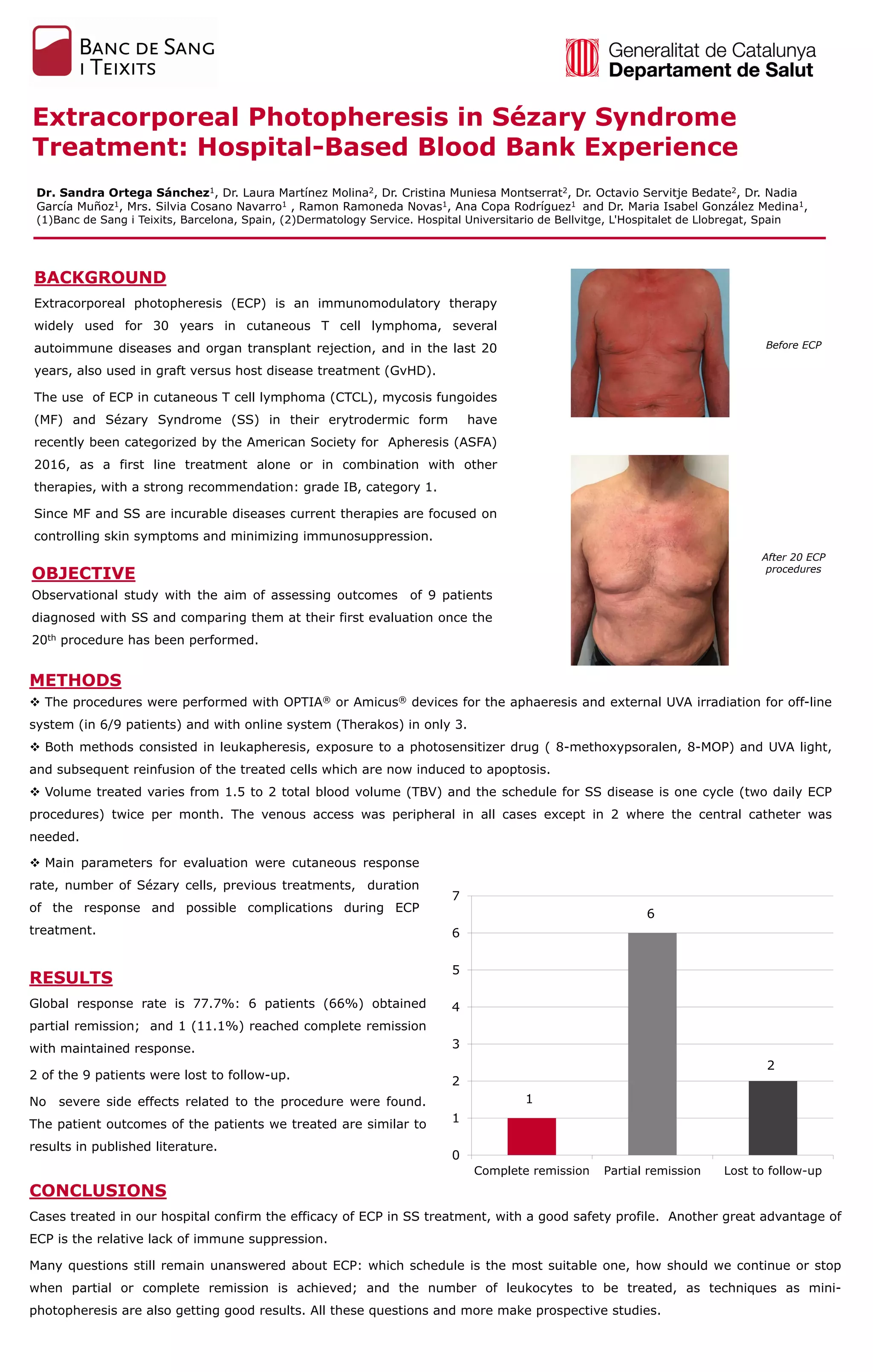 ECP Effective Sézary Syndrome Treatment Hospital Experience | PDF