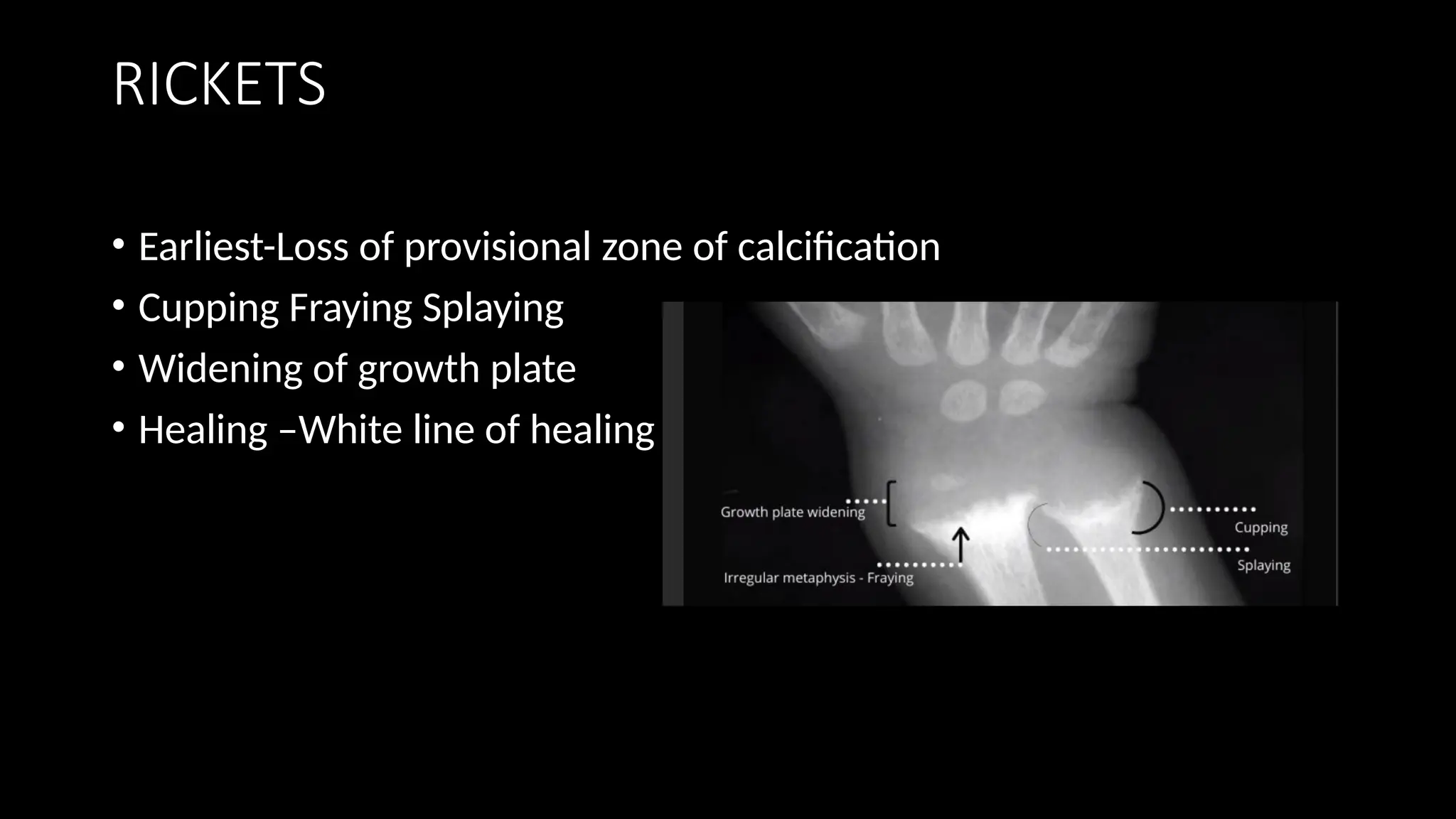 skeletal SYSTEM RADIOLOGY And associated findings.pptx