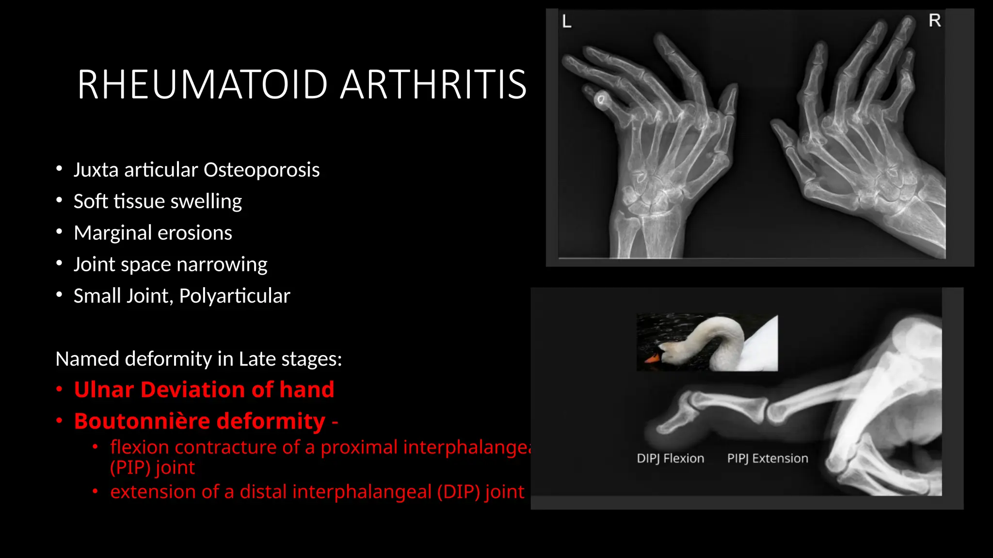 skeletal SYSTEM RADIOLOGY And associated findings.pptx