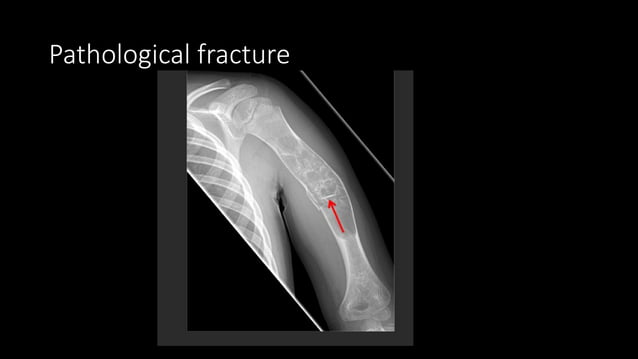 skeletal SYSTEM RADIOLOGY And associated findings.pptx