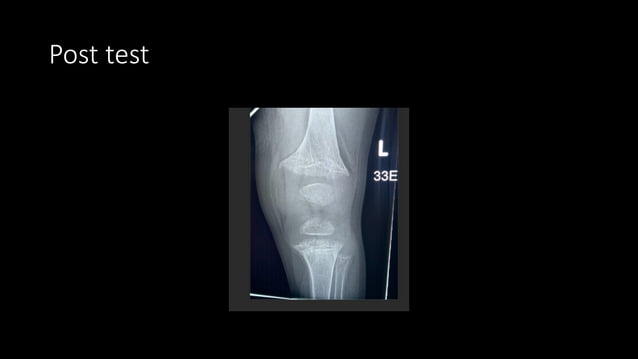 skeletal SYSTEM RADIOLOGY And associated findings.pptx