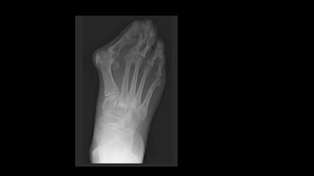 skeletal SYSTEM RADIOLOGY And associated findings.pptx
