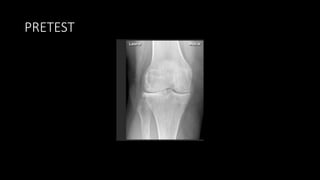 skeletal SYSTEM RADIOLOGY And associated findings.pptx