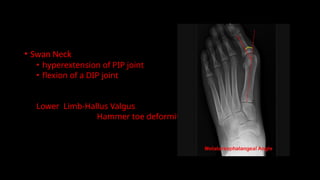 skeletal SYSTEM RADIOLOGY And associated findings.pptx