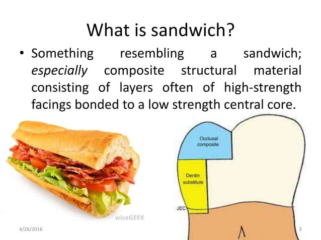 Sandwich technique | PPTX