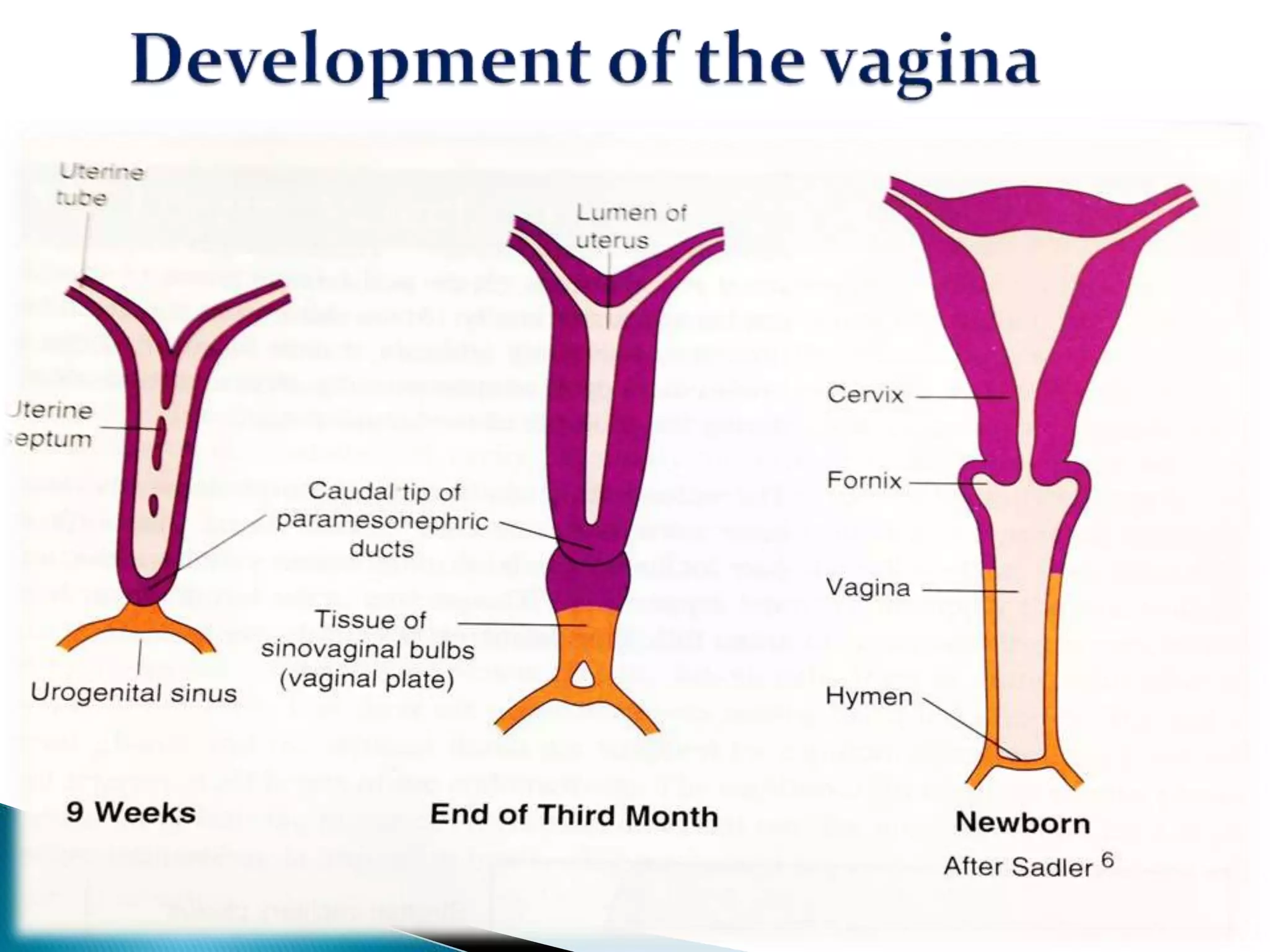 Anatomy of female genital tract | PPTX