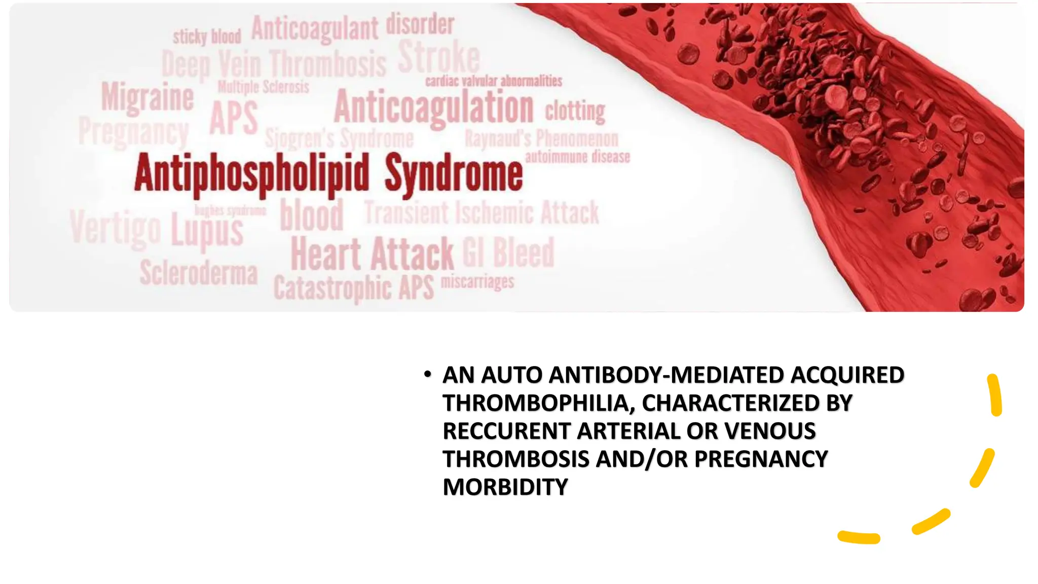 Left homonymous hemianaopia secondary to primary apla | PPTX