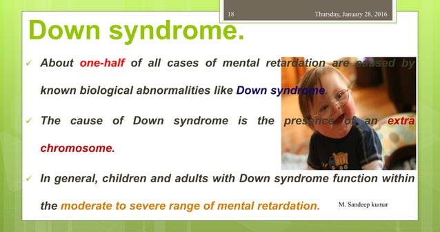 PPT ON MENTALLY CHALLENGED CHILDREN OR MENTAL RETARDATION IN CHILDREN | PPT