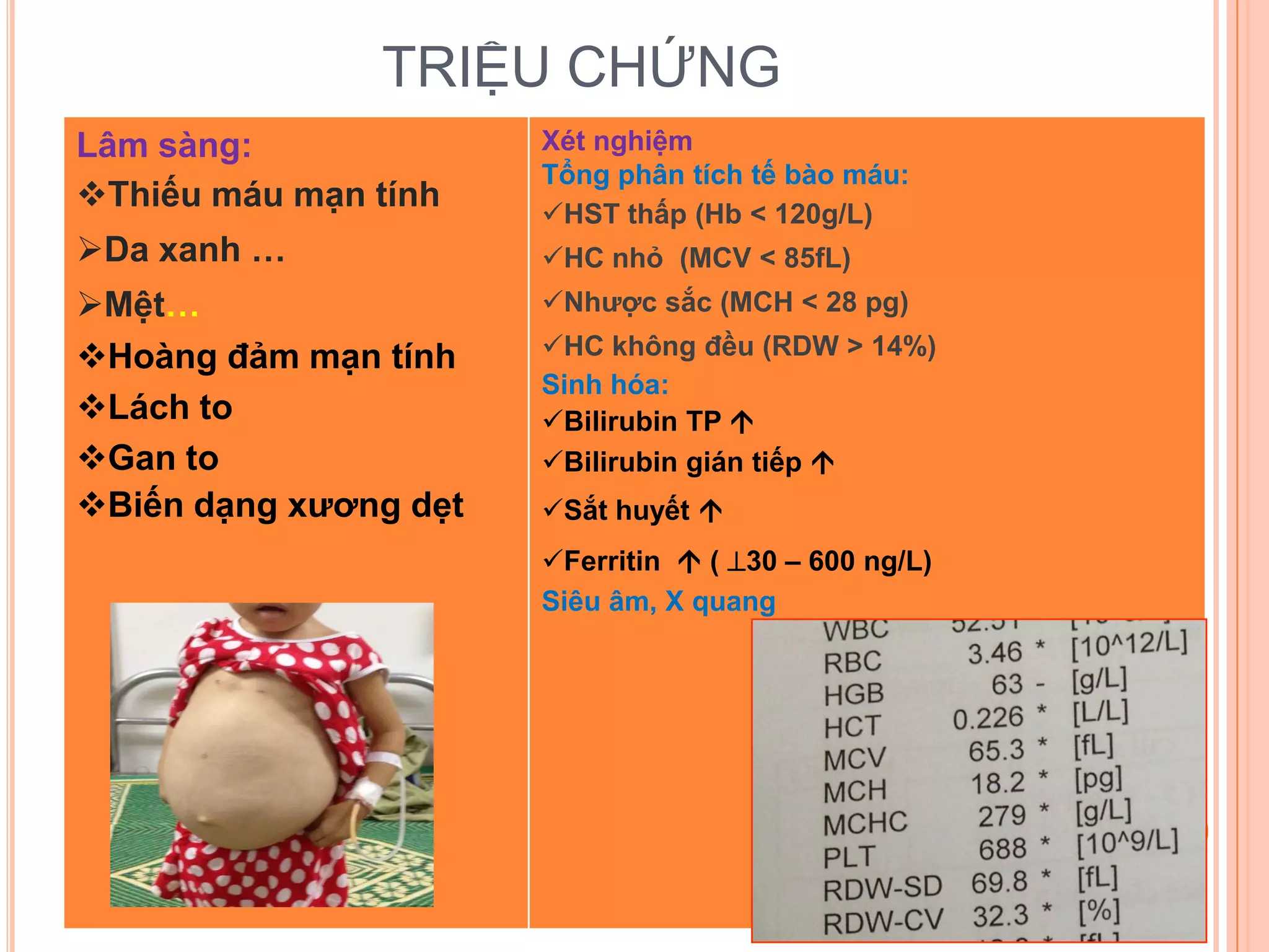 Sang loc thalassemia | PDF