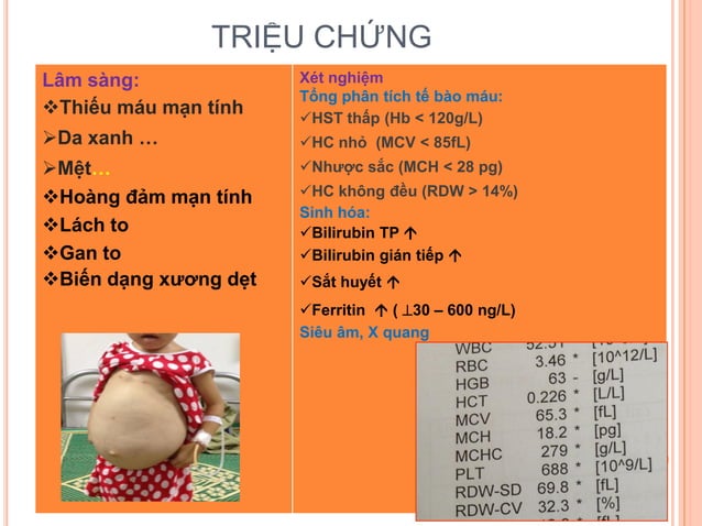 Sang loc thalassemia | PDF