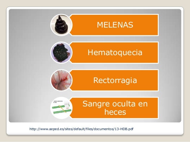 Sangrado digestivo bajo